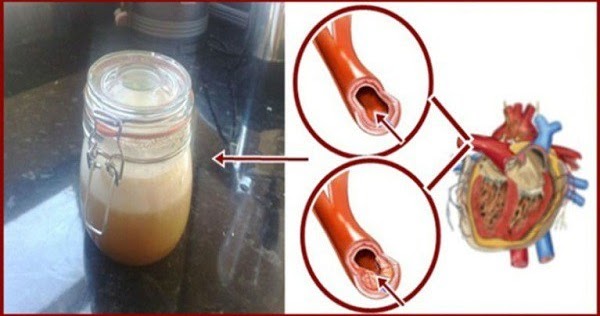 Get Rid Of High Blood Pressure Triglycerides And Cholesterol With This get-rid-of-high-blood-pressure-triglycerides-and-cholesterol-with-this