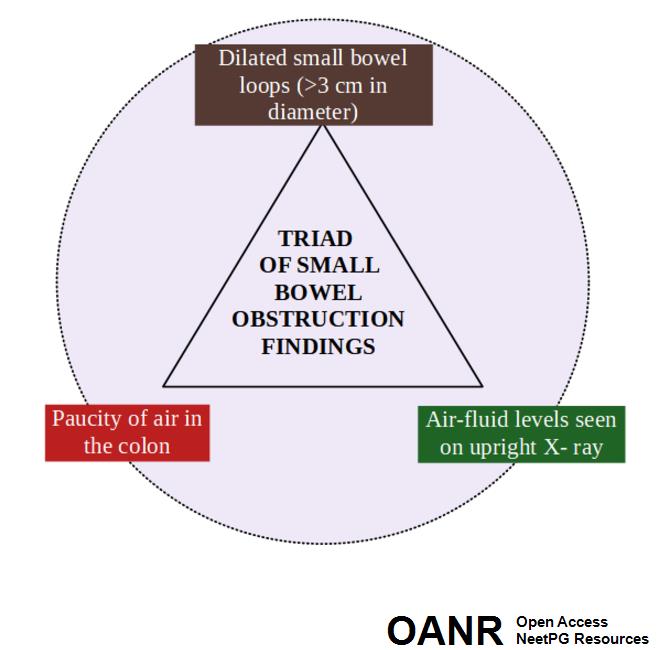 Triad of Small bowel obstruction.