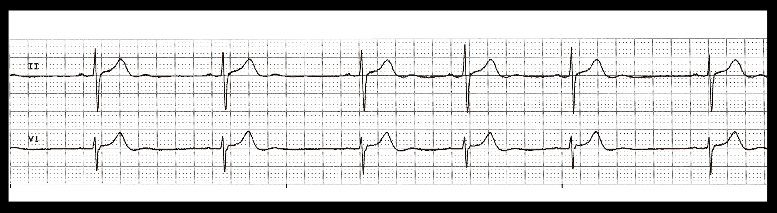 Practice EKG Strips 308