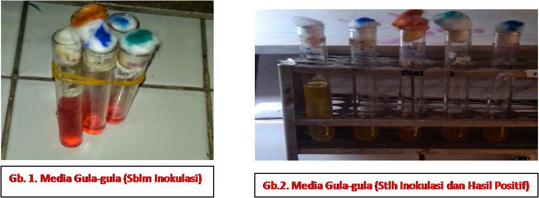 Artanta-Bagus: Uji Media Biokimia