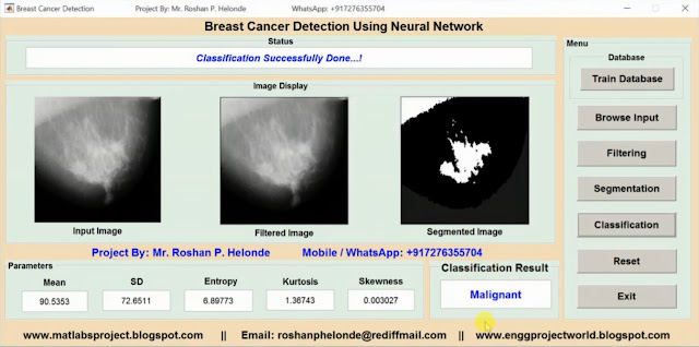 Breast Cancer Detection Using Neural Network Matlab Project with Source ...