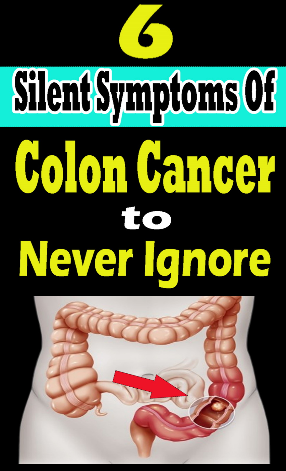 6 Silent Symptoms Of Colon Cancer to Never Ignore - wellness magazine