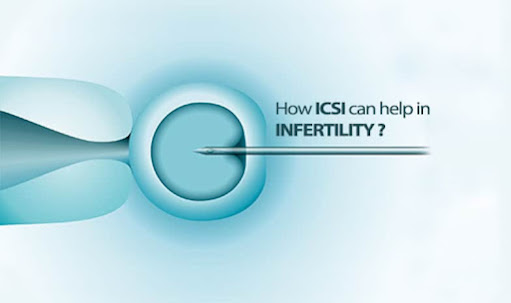 How ICSI can help in infertility? IFH Center