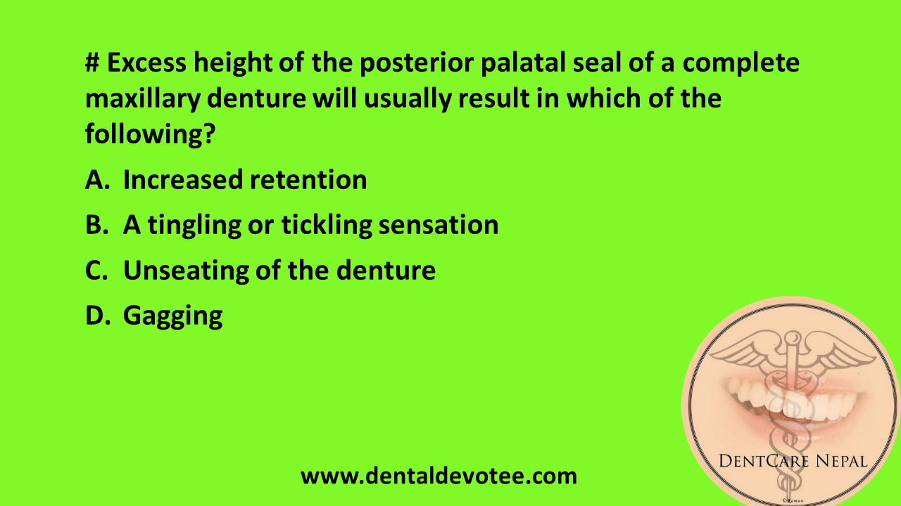 Dentosphere World Of Dentistry Posterior Palatal Seal Dentosphere World Of Dentistry Posterior Palatal Seal