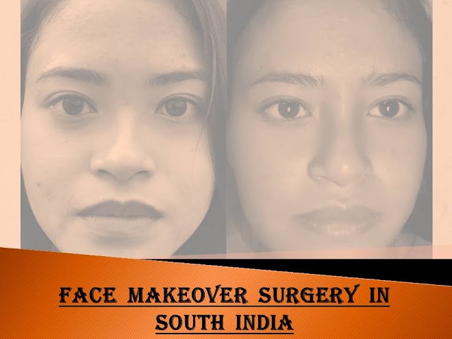 TMJ or lower jaw joint dislocation - Presenting findings and treatment ...