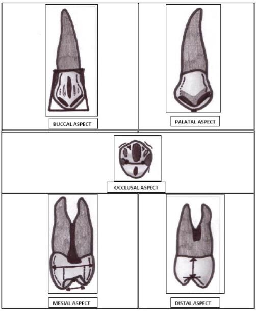 Permanent maxillary first premolar l tooth crown & root morphology ...