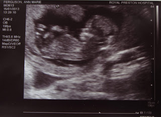 Simons Baby Blog: 12 Week Scan