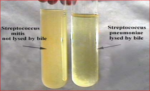 Bile Solubility Test