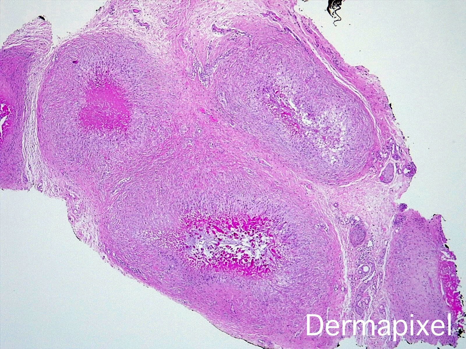 Dermapixel: noviembre 2021