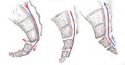 Centro de Terapias Zenit: SUBLUXACIÓN DE COXIS, DOLOR DE COXIS O ...