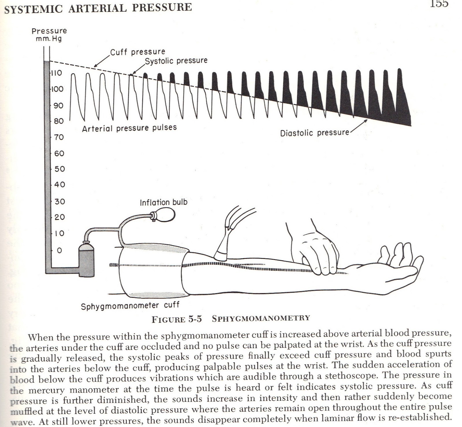 Pedi cardiology: Pulsus Paradoxus