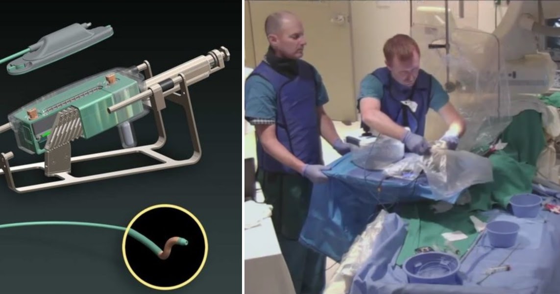 Project Moray Robotic Catheter System
