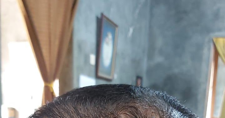 Mengembalikan Kondisi Rambut yang Rusak Akibat Rontok