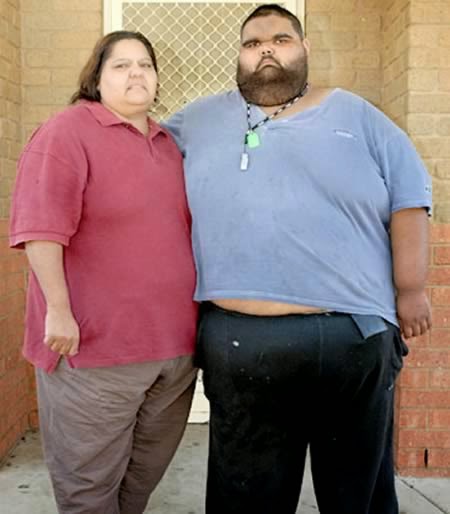 9 Strange Shocking Cases of When You Are Too Fat To ~ Unusual Things