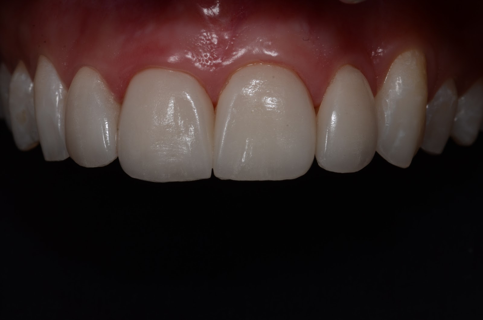 Estética, Belleza y Armonía en odontología