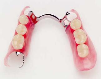 Valplast (gigi tiruan lepasan) ~ Dentana and Dentina