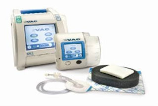 傷口大師: KCI VAC負壓傷口治療機的發展歷史