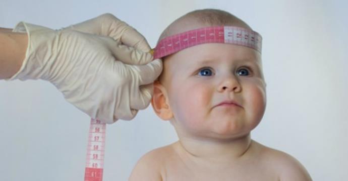 PEDIATRANDO: O que é microcefalia e o quanto devemos nos preocupar?