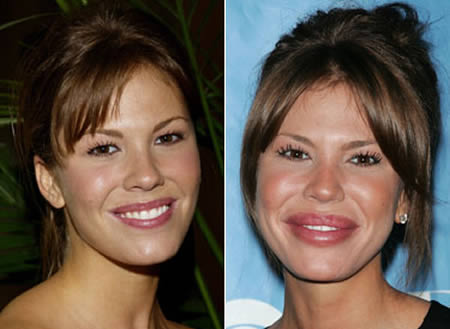 Wallpaper Leah: 12 Weirdiest Plastic Surgery Makeovers