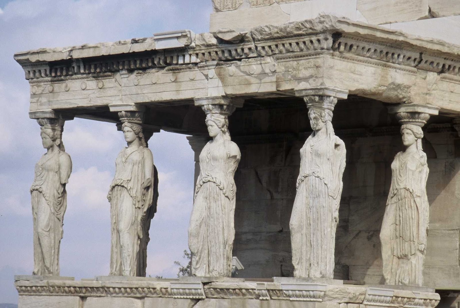 HISTORIA DE LA MEDICINA UNERG: EL SÍNDROME DE LA CARIÁTIDE