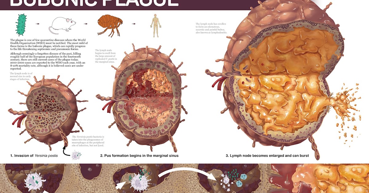 The Big Wobble : The World Health Organisation has warned this year's ...