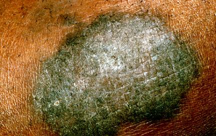 EL RINCÓN DE LA MEDICINA INTERNA. juanpedromacaluso@yahoo.com.ar ...