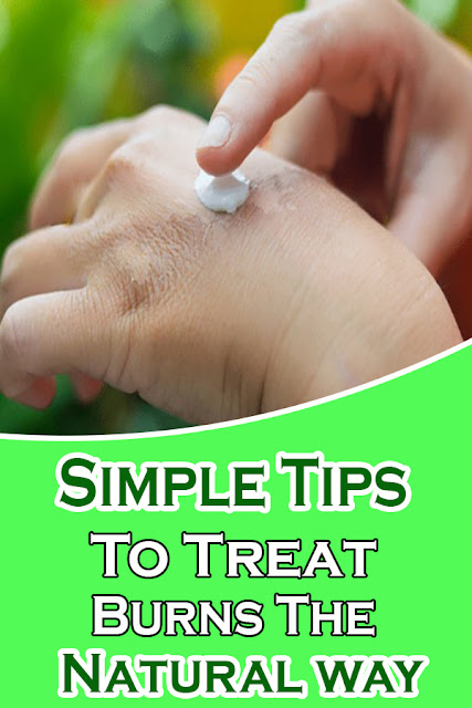 Simple tips to treat burns the natural way - healthyremediesviral ...