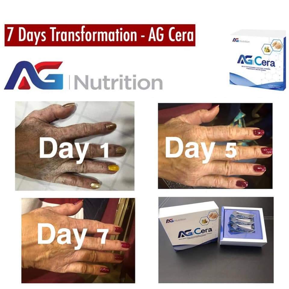 AG CERA | SUPLEMEN ANTI OKSIDAN TERBAIK DI DUNIA | KEMBALI SIHAT DAN ...