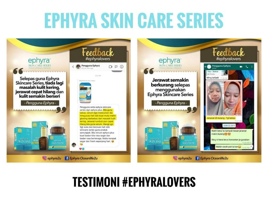EPHYRA SKIN CARE SERIES | 3 Langkah Mudah Kulit Bebas Jerawat dan ...