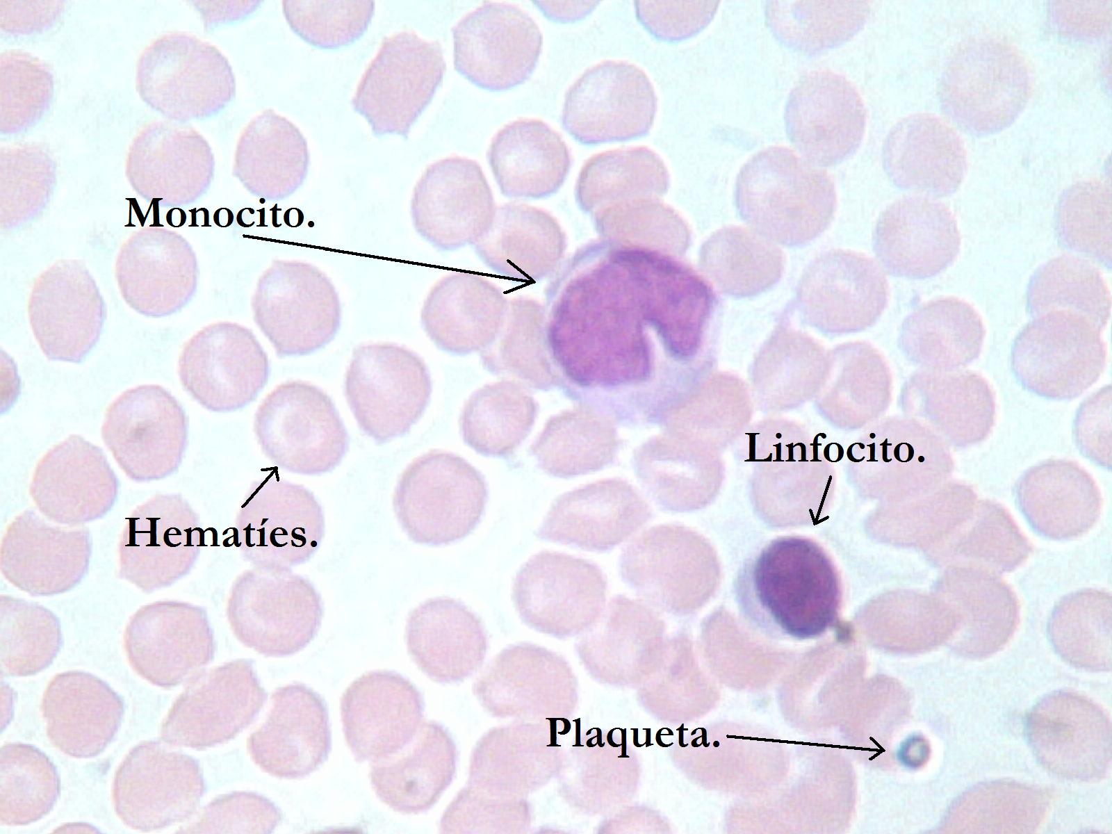 Leucoblog: Tinción Giemsa.