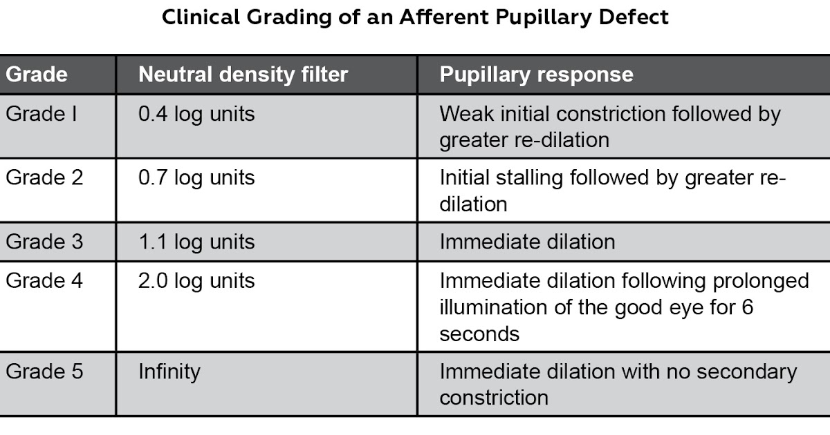 Ophthalmology Notes: RAPD GRADING