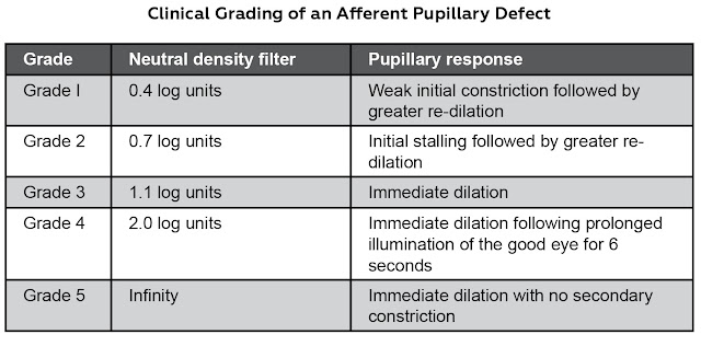 Ophthalmology Notes: RAPD GRADING