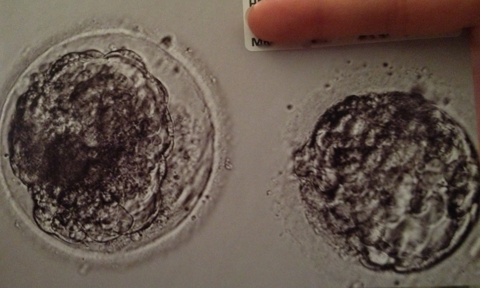 Meier Madness!: Our TTC Journey