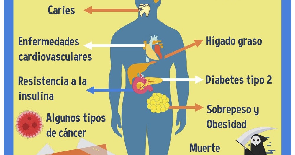LAS INTELIGENCIAS MÚLTIPLES: EFECTOS DEL AZUCAR