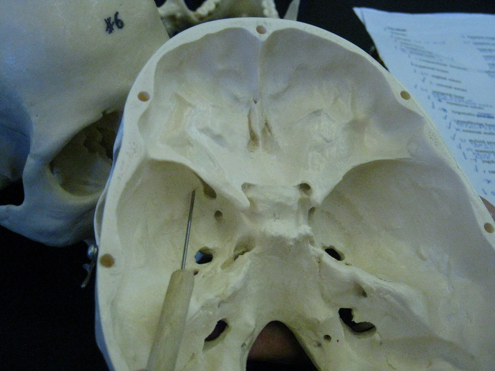 Boned: Human Skull - greater wings (of sphenoid bone)