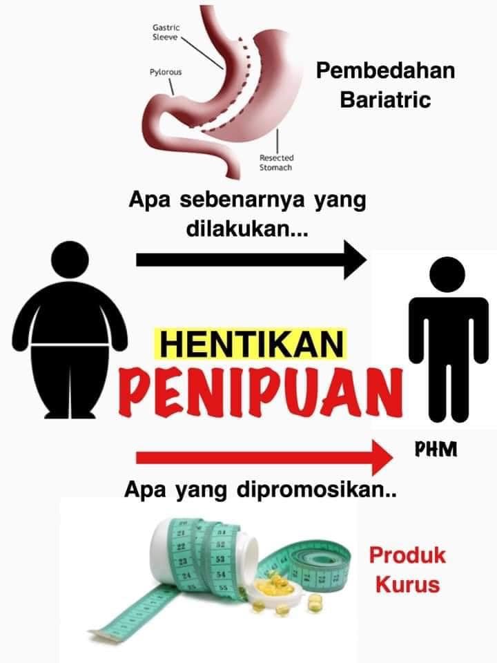 APA ITU PEMBEDAHAN PINTASAN PERUT (BARIATRIC)?
