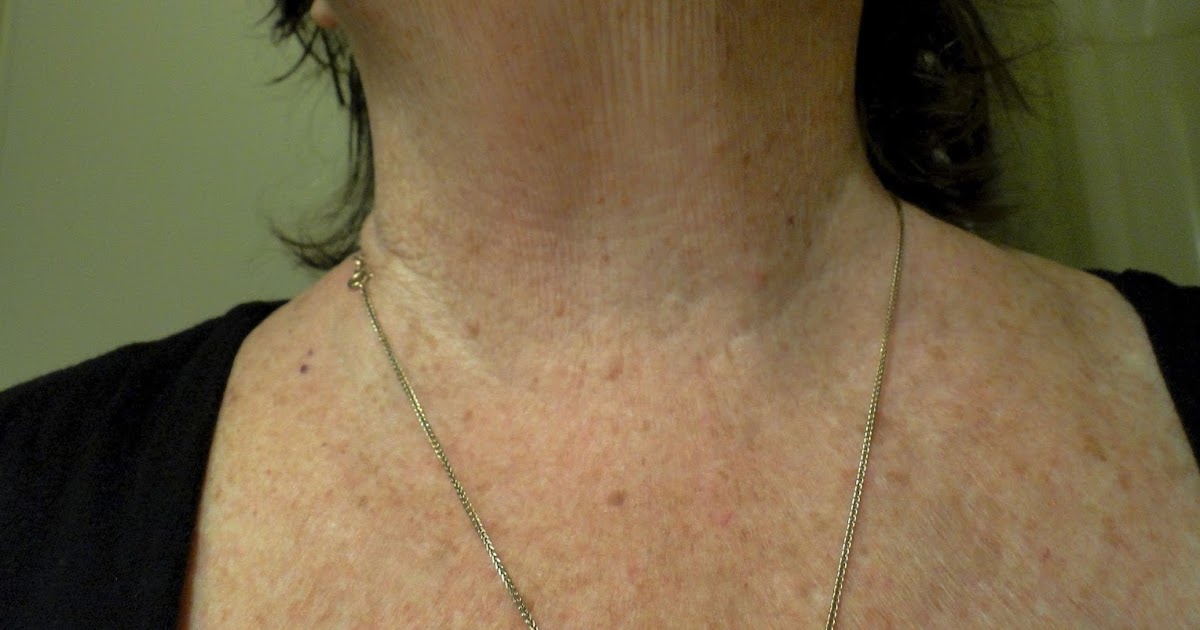 ALIEN ABDUCTIONS EFFECTS: Very Strange Neck Photo