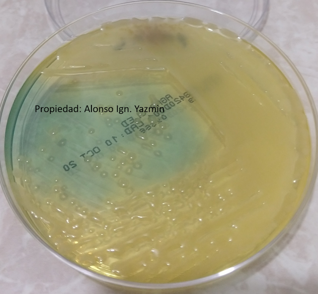 Bioquímica Diagnóstica BQD-YAI: Enterobacter cloacae