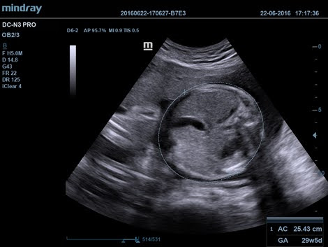 USG 4 Dimensi DC-N3 PRO Mindray, USG 4D Terbaik dan Tercanggih ...