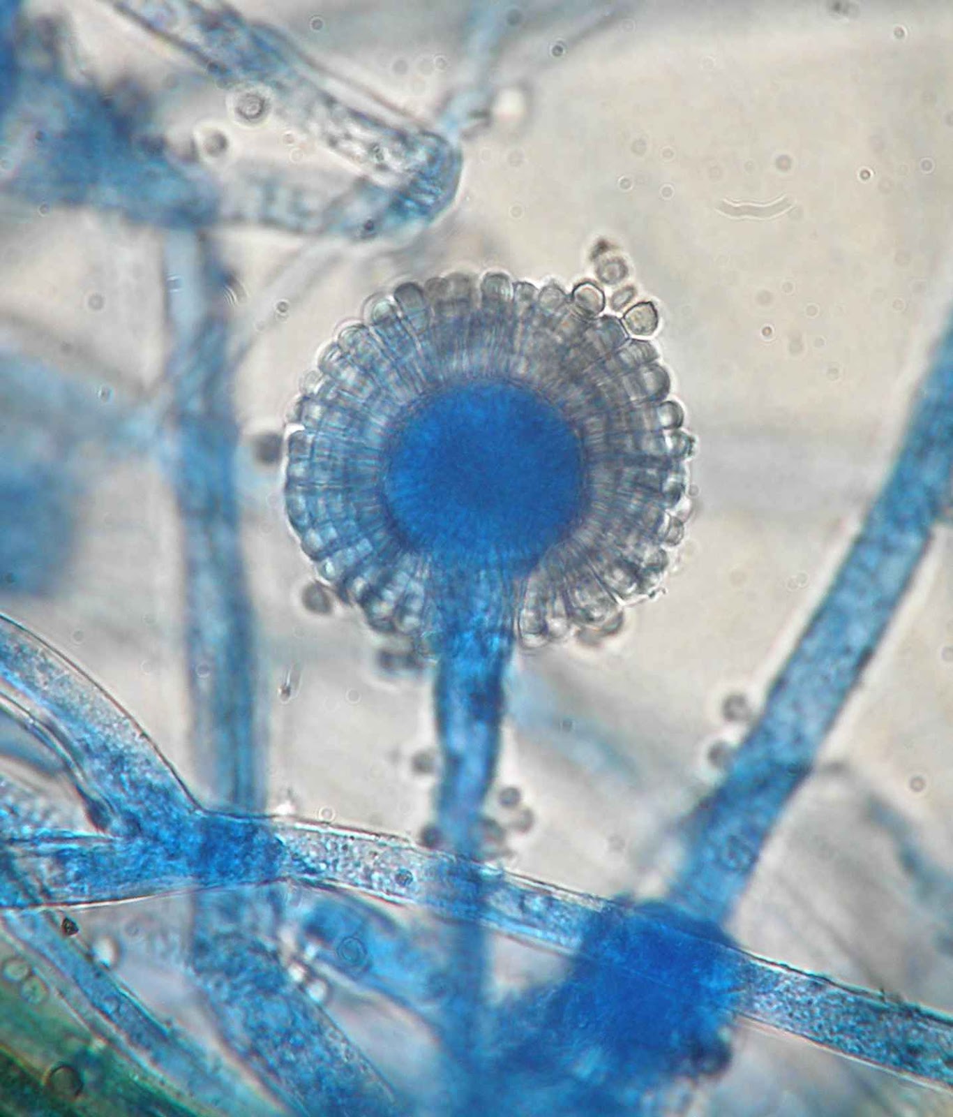 ATLAS MICOLOGIA: SYNCEPHALASTRUM RACEMOSUM