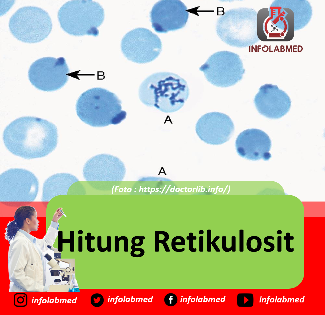 Hitung Retikulosit Sediaan Kering dan Sediaan Basah