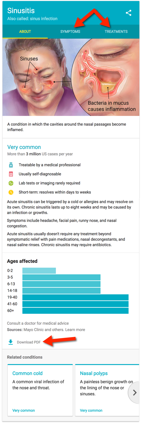 SearchReSearch: Delays... and Knowledge Panels