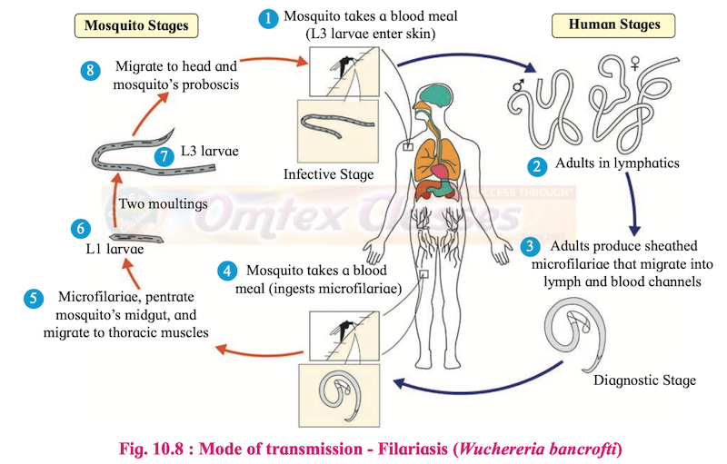 Elephantiasis Diagram