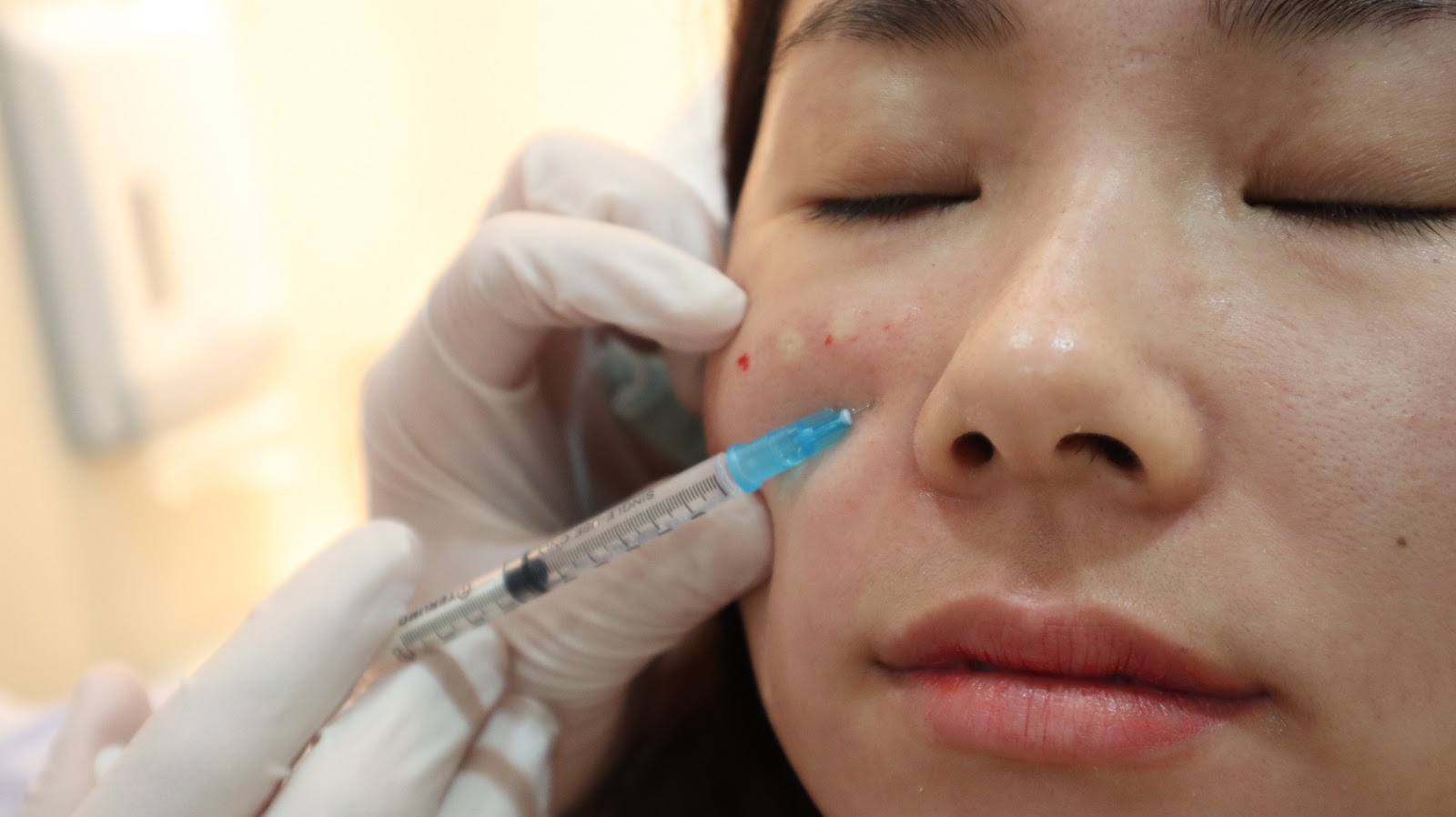 MY EXPERIENCE WITH REJURAN HEALER , ASTIQUE CLINIC, PRICE - MONGABONG