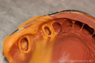 Dental Lab Model Pouring | Making Noise And Drinking Beer