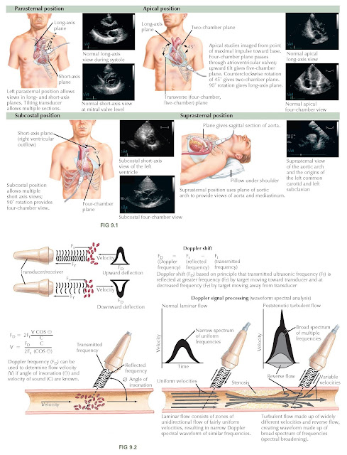 ECHOCARDIOGRAPHY - pediagenosis