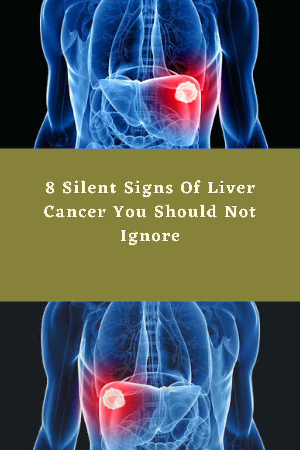 8 Silent Signs Of Liver Cancer You Should Not Ignore