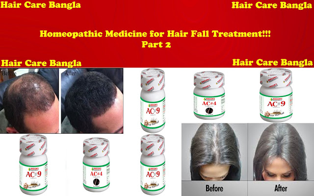 Hair Care Bangla Homeopathic Medicine For Hair Fall Treatment Ac 9