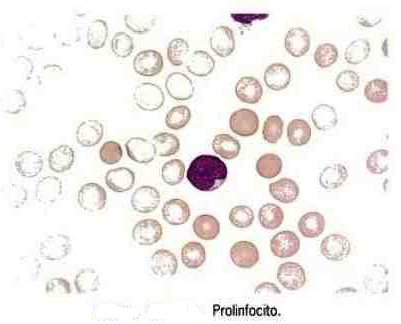 FICHERO DE HEMATOLOGIA: Leucopoyesis