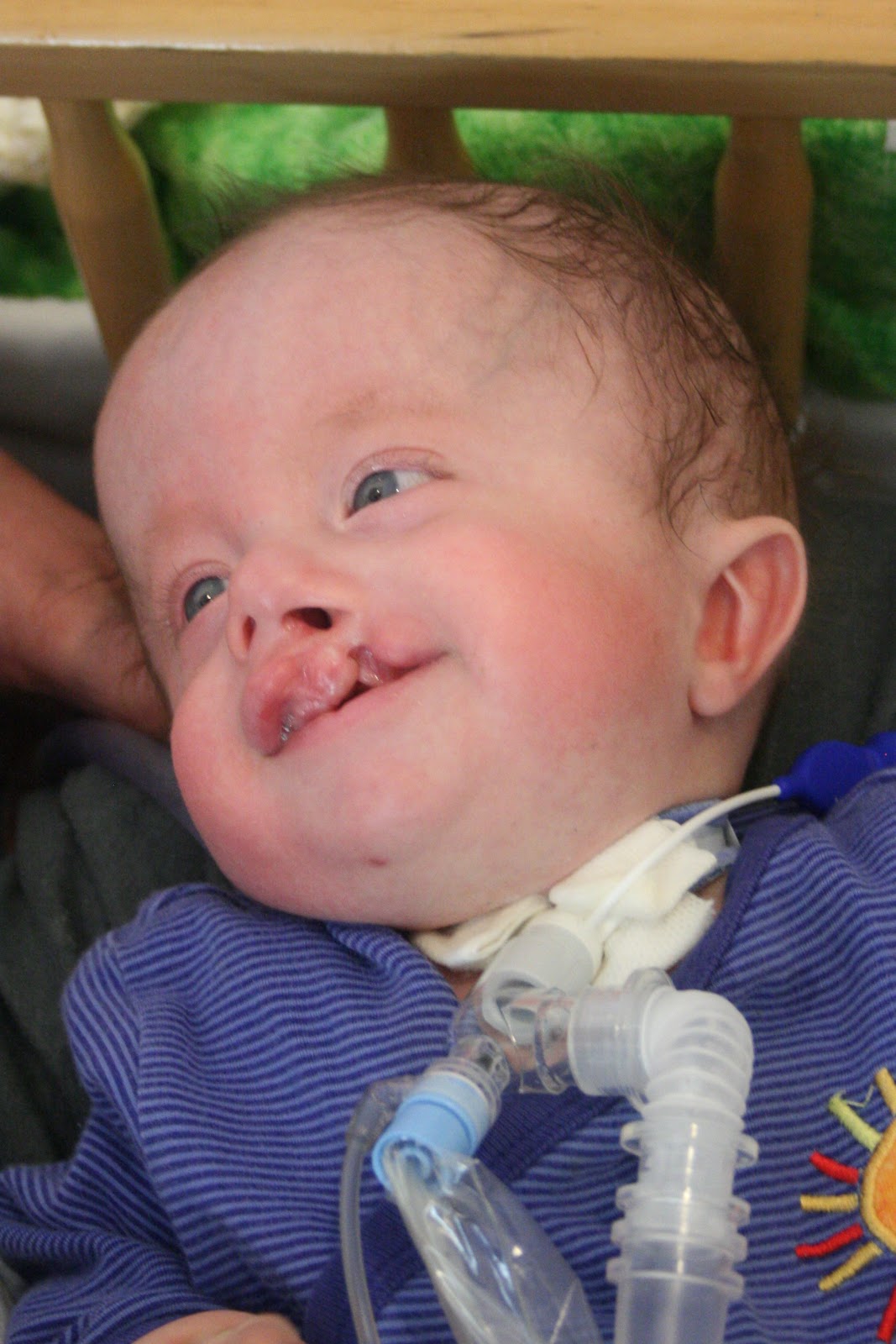 Compatible With Joy-Trisomy18: Happy 11 Months!